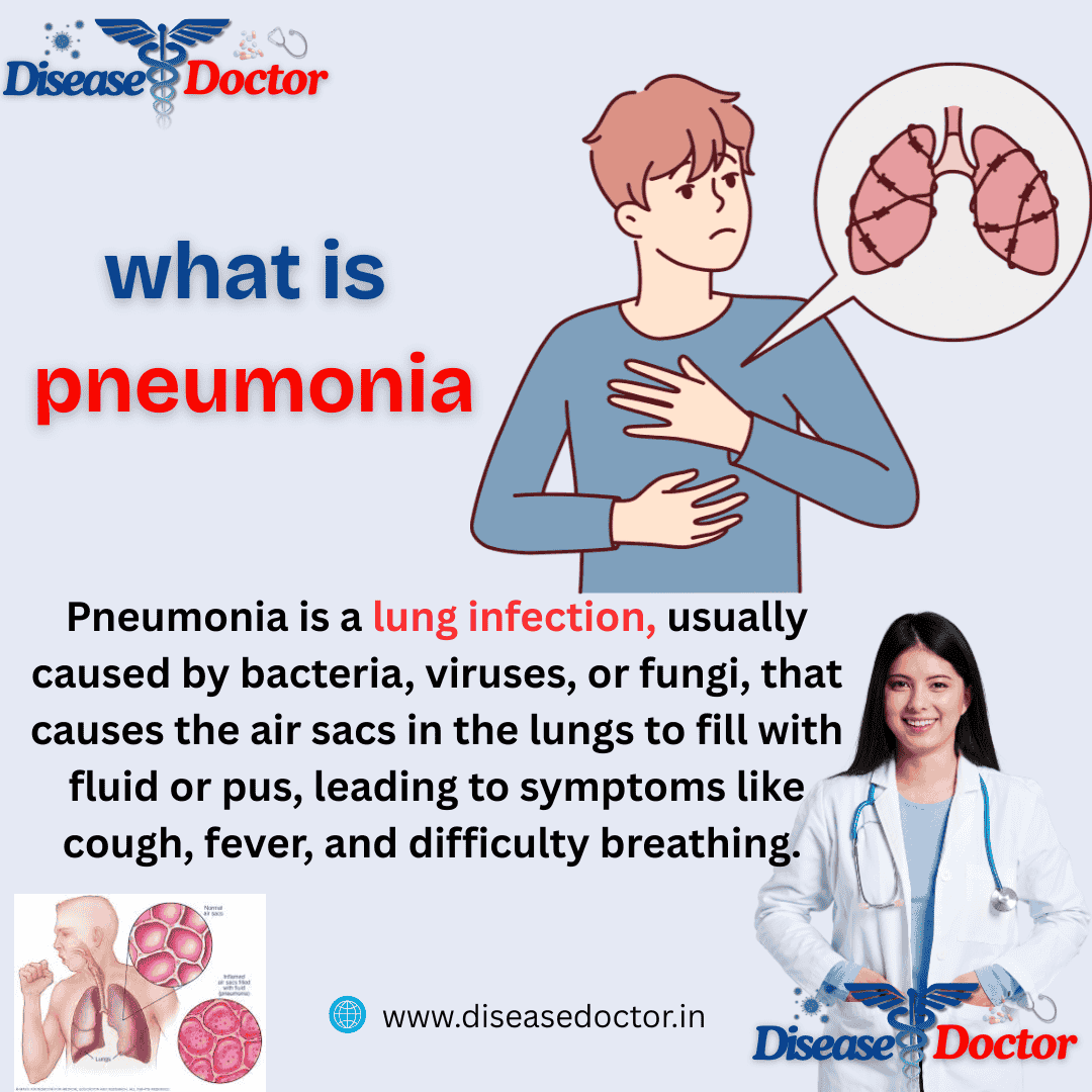 "Pneumonia: 7 Powerful Facts About Causes, Symptoms & Treatment ...