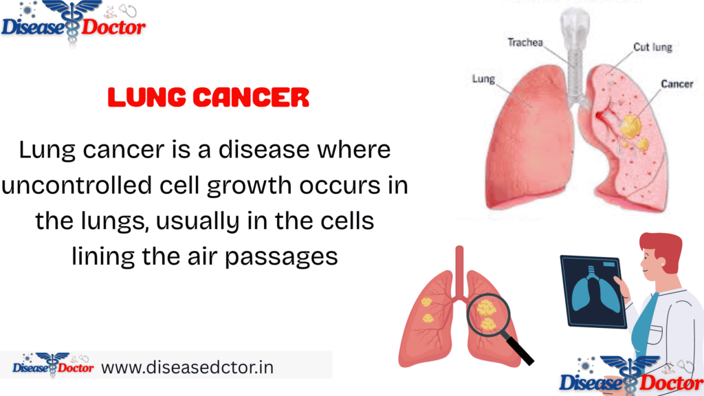 “Lung Cancer Explained: 7 Life-Saving Facts, Symptoms & Powerful ...
